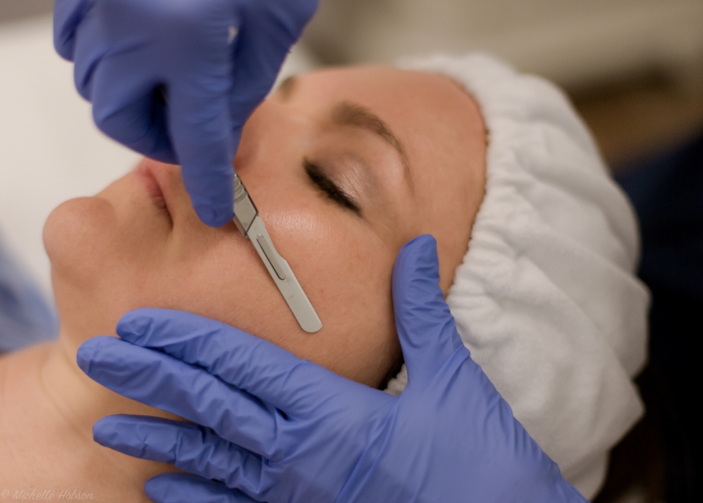 Dermaplaning Dermal Edge Therapy Epidermal Leveling Blading
