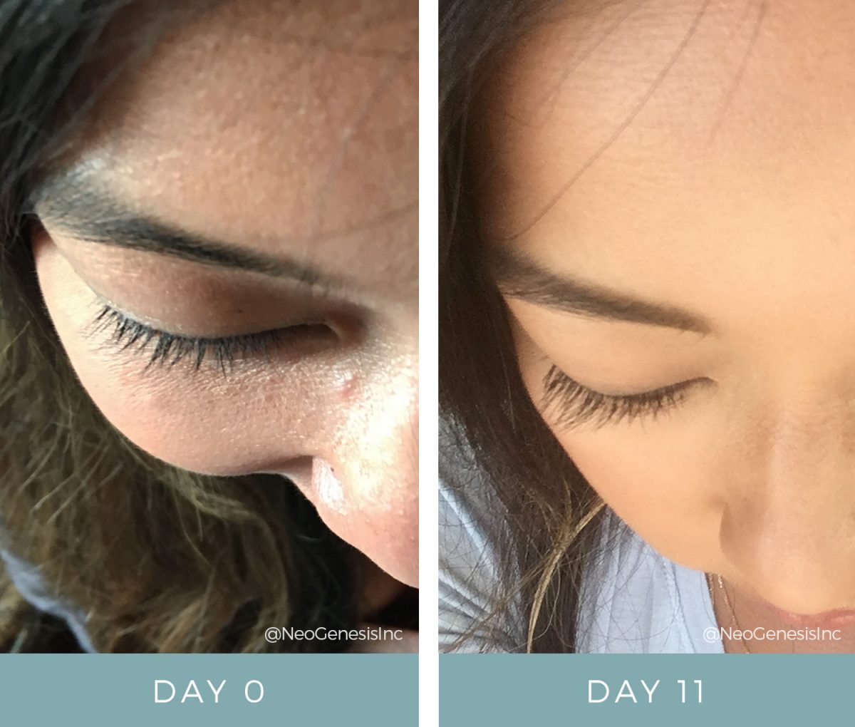 NeoLash Review Eye Lash Growth NeoGenesis NeoLash Serum