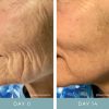 NeoGenesis Recovery Serum Advanced Cellular Serum