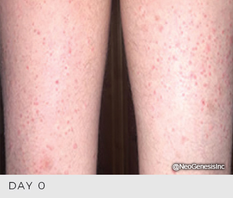 Discover the Best Products to Relieve Dermatitis Rash