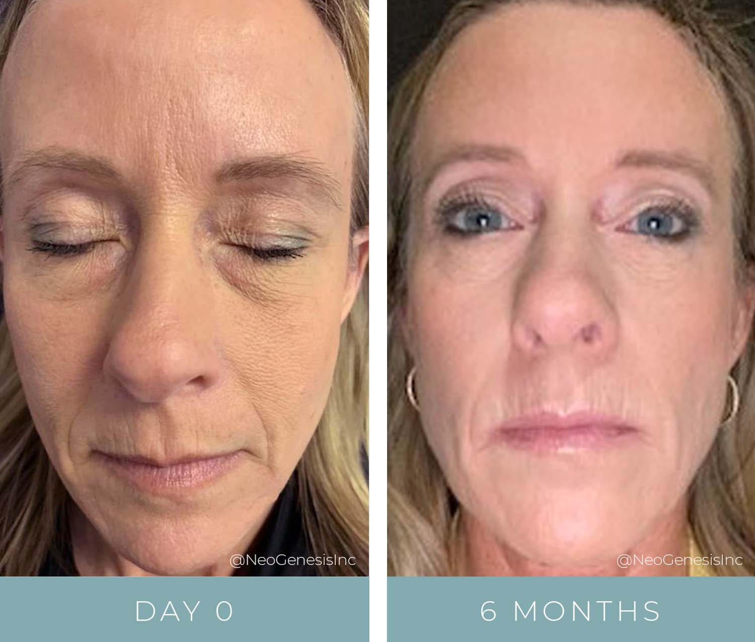 Transform Your Ageing Skin: Before and After Results