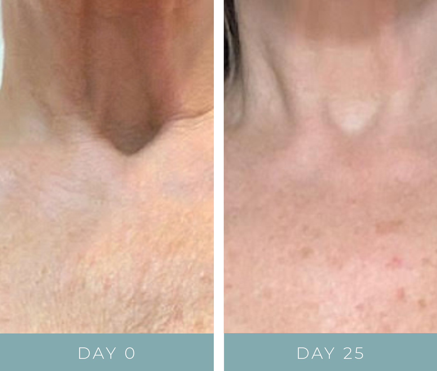 How to Address an Ageing Neck with Skin Care Products