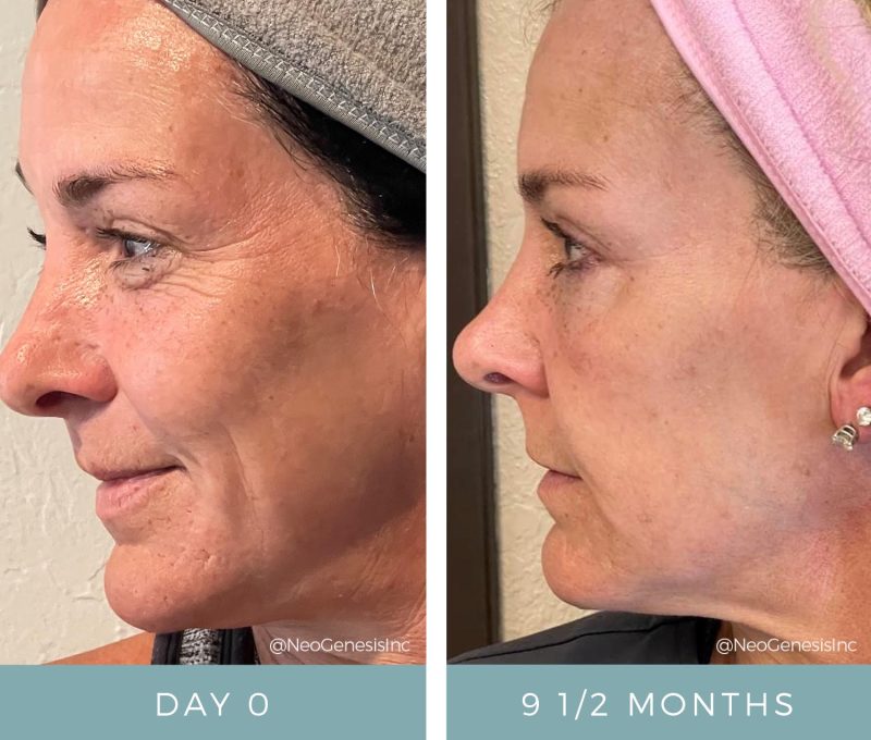 Address Ageing Skin with NeoGenesis Skincare Products