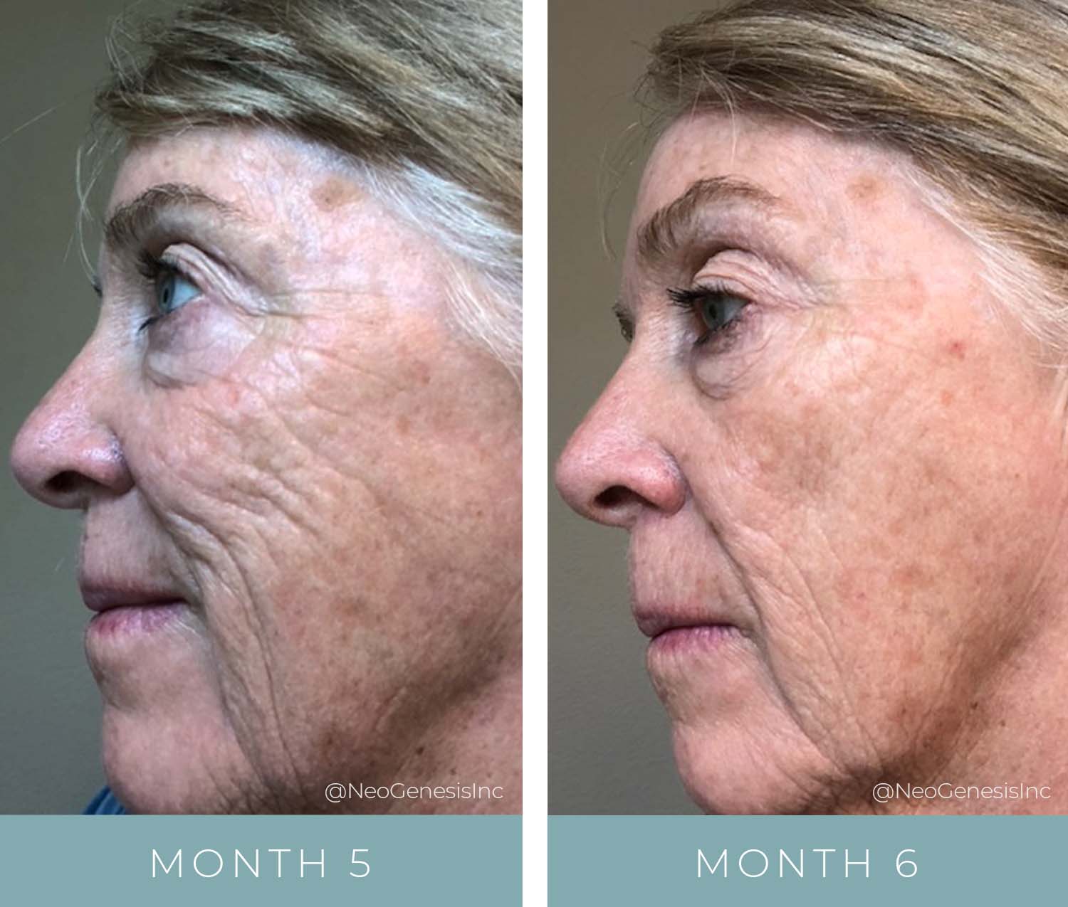Transform Ageing Sun Damaged Skin with Effective Skin Care