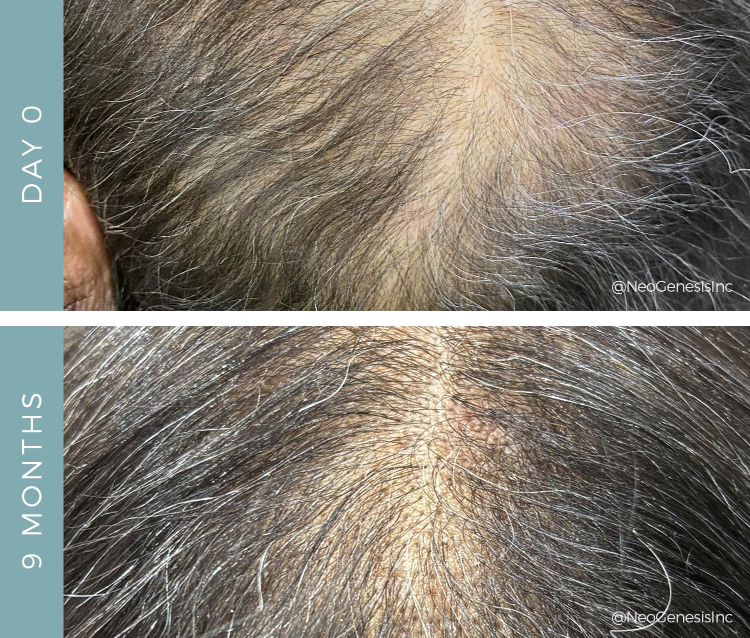 Skin + Hair Condition Before + After - NeoGenesis Pro Australia