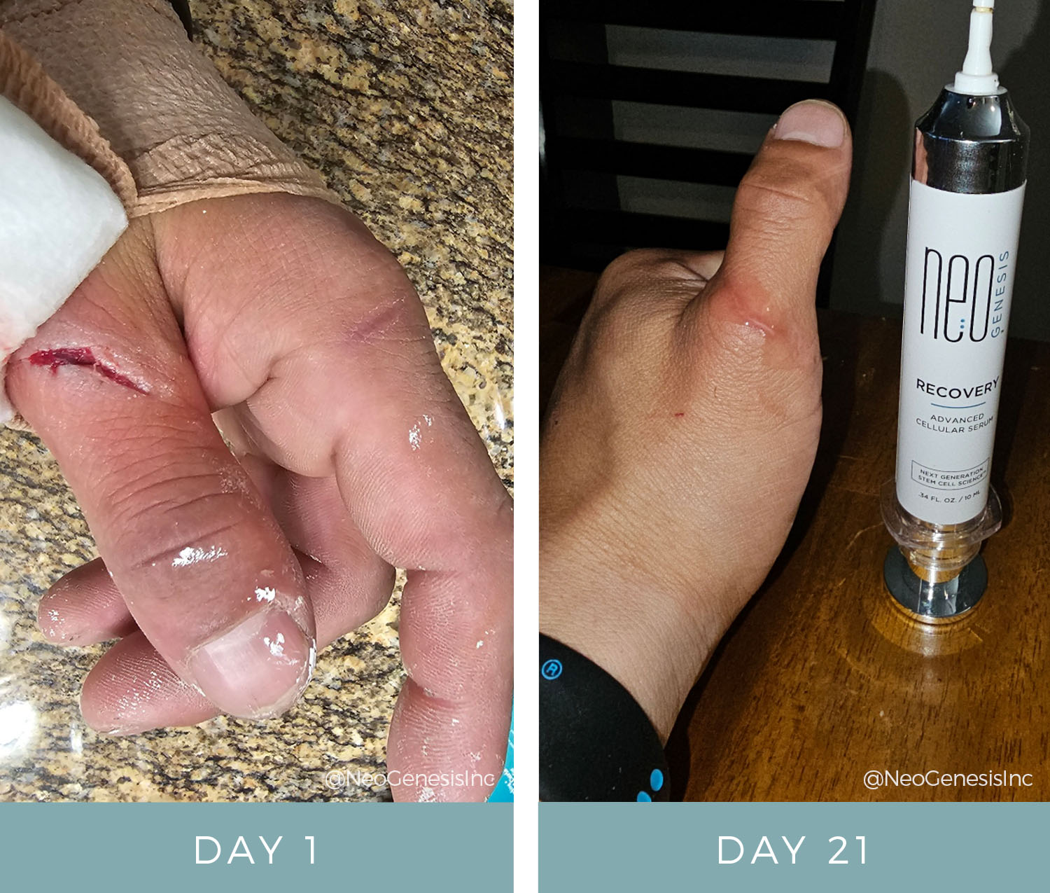 Wound Skin Care for Accidents Before + After Photos Testimonial